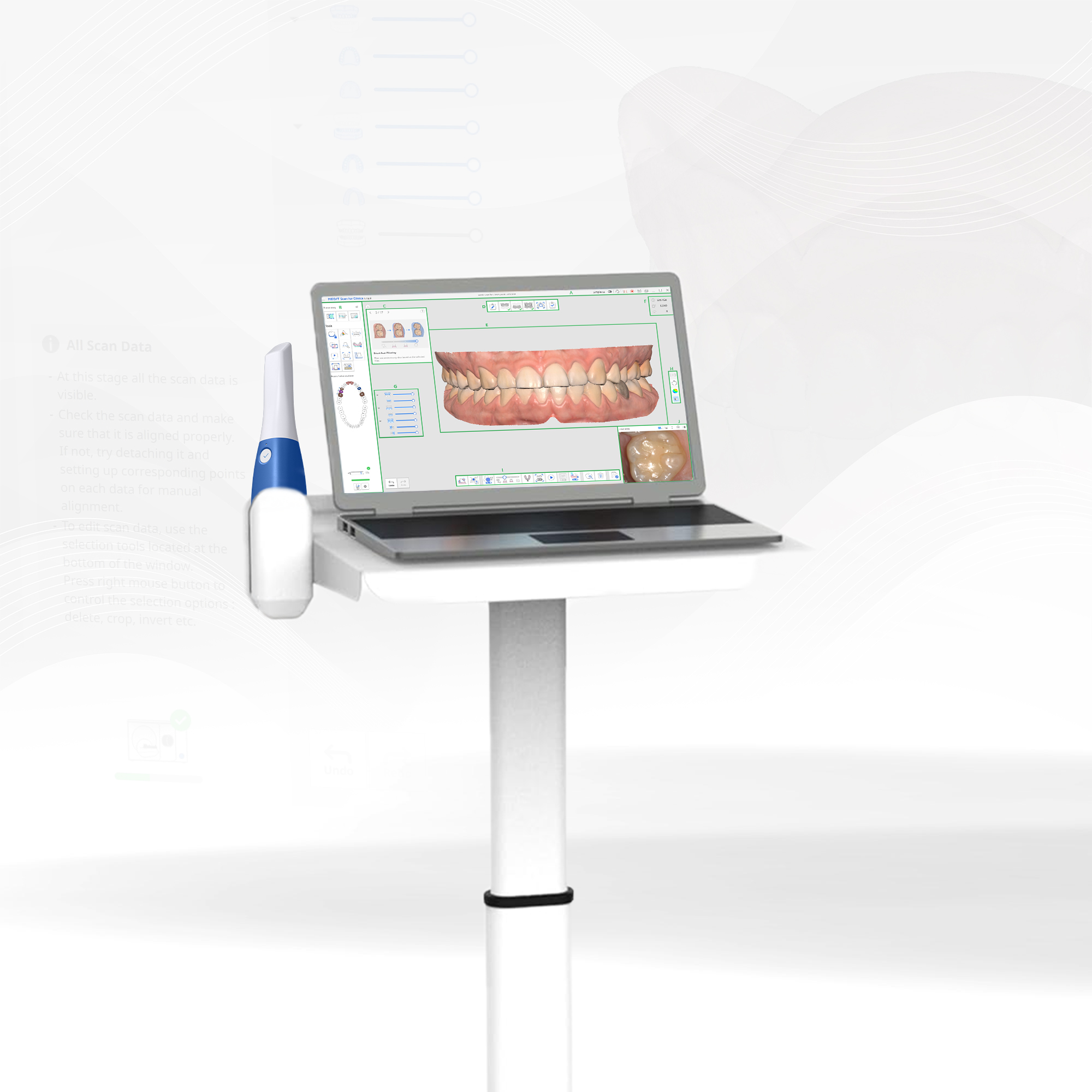 i600 + Mount Plus Trolley System (MacBook Pro) - iOScanners Direct
